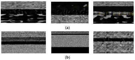 Enhanced Image Based Malware Classification Using Transformer Based