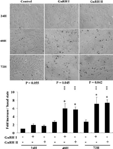 Time Dependent Apoptotic Effects Of Gnrh I And Ii On Human