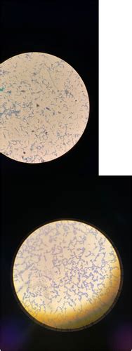 Microbiology Practical Exam Flashcards Quizlet