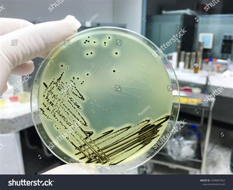 52 Imágenes De Baird Parker Agar Imágenes Fotos Y Vectores De Stock Shutterstock