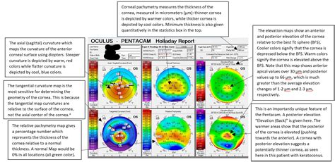 Normal Corneal Topography