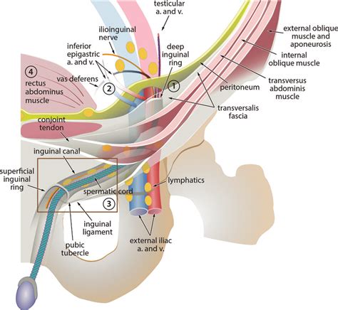 Diagram Of The Ic And Its Contents The Deep Inguinal Ring Is Formed By