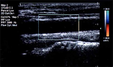 Chapter Physics Flashcards Quizlet Chapter Physics Flashcards Quizlet