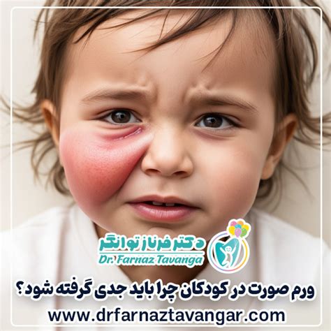 ورم صورت در کودکان چرا باید جدی گرفته شود؟ دکتر فرناز توانگر