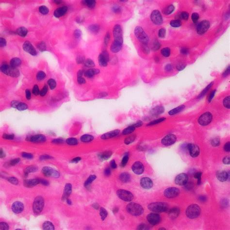 Human Simple Squamous Epithelium Sec 7 µm Hande Microscope Slide