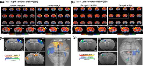 Seed Based Mapping Of The Somatosensory Cortex Functional Connectivity Download Scientific