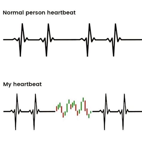 Life Of A Trader R Ethtrader