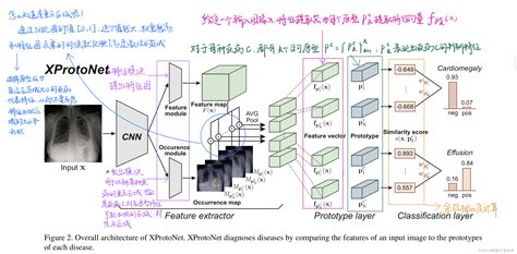 论文笔记＜xprotonet自动诊断框架 胸片诊断的全局和局部解释＞ xpronet csdn博客