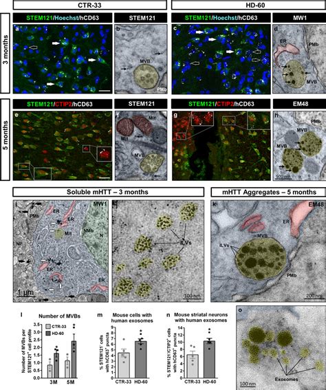 Upregulation Of The Exosomal Secretory Pathway In Human Striatal