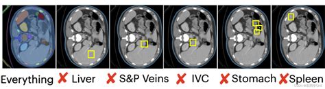 论文代码复现之medical Sam Adapter Junde Wu Versionruntimeerrorfapplying