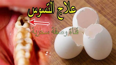 افضل علاج لتقويه الأسنان بالأعشاب