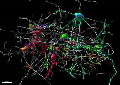 Imaris 100 Microscopy Image Analysis With Ai Filament Tracer
