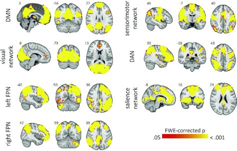 Large Scale Intrinsic Connectivity Networks Of Interest Images Depict