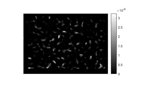 Matlab Frangi Filter Enhanced Unwanted Objects Stack Overflow