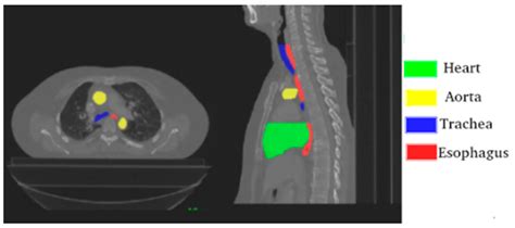 Multi Organ Segmentation Using A Low Resource Architecture