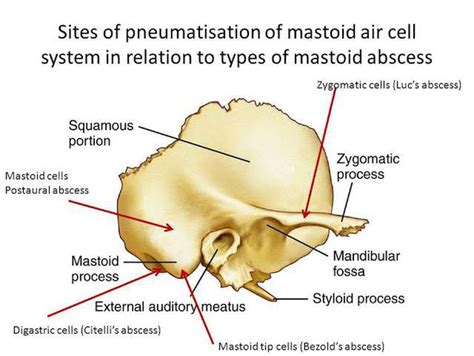 Was Sind Mastoidzellen Mastoiditis Ursachen Symptome Diagnose