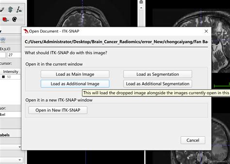 介绍一种医学影像配准的方法（使用itk snap itksnap使用教程 csdn博客