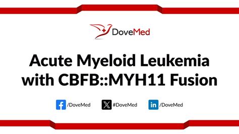 Acute Myeloid Leukemia With Cbfbmyh11 Fusion Dovemed