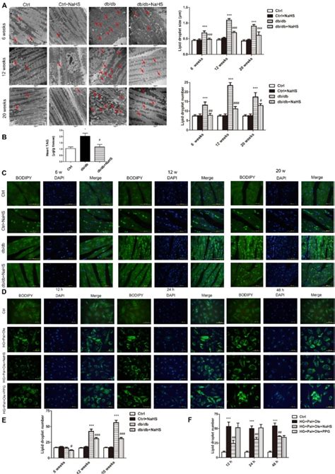 Exogenous H2s Induces Hrd1 S Sulfhydration And Prevents Cd36 Translocation Via Vamp3