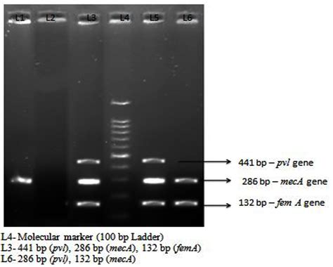 Prevalence Of Methicillin Resistant Staphylococcus Aureus And Its Associated Sccmec Types Among