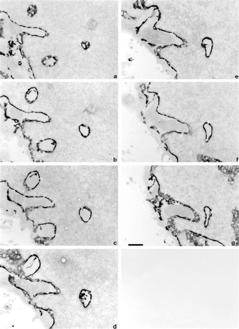 Interphase Nuclei Of Many Mammalian Cell Types Contain Deep Dynamic Tubular Membrane Bound