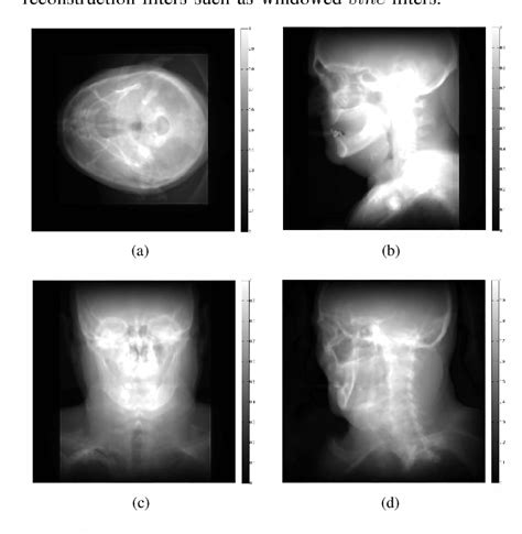 Figure 1 From Matlab Based Fourier Volume Rendering Framework
