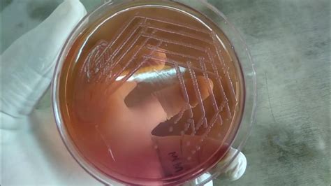 Morgenella Morganii Colony Morphology On Macconkey Agar Demonstration Youtube