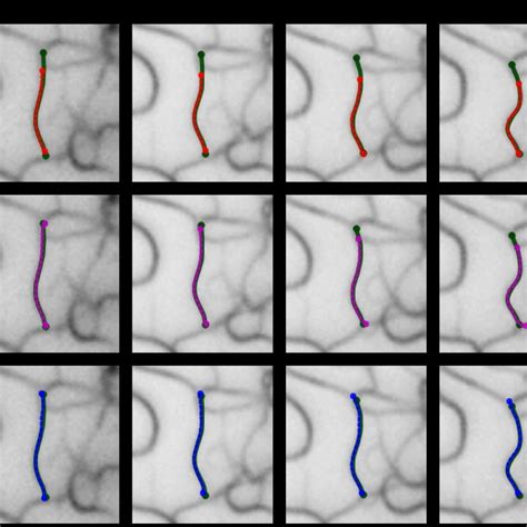 The Main Image Processing Steps A Original Image E Frangi Filter Download Scientific