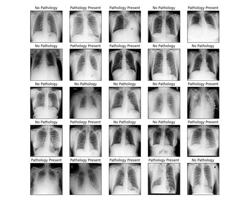 Model Card Nih Chest X Ray Dataset Model Card Nih Chest X Ray Binary