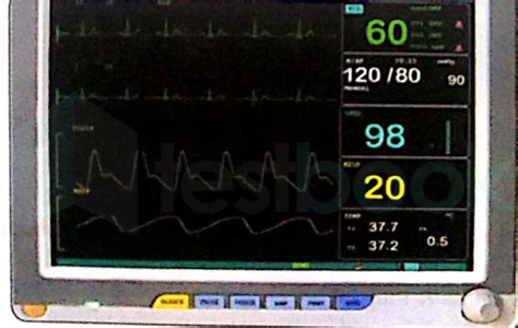 Solved Identify The Red Waveforms In The Following Image