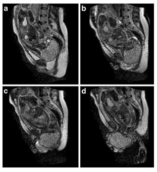 Sexo na ressonância magnética Asclépios