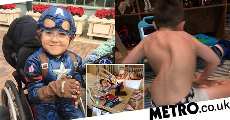 Boy Has Rare Disorder Causing His Organs To Be Crushed By His Spine
