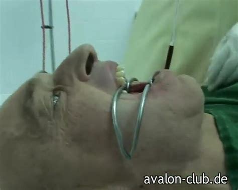 Strict Dentist Thisvid Com