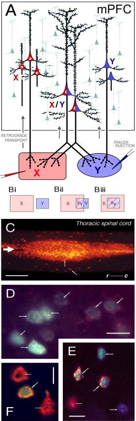 A Dual Retrograde Labelling Two Different Fluorescent Retrograde
