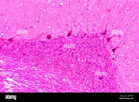 Purkinje Cells Histology