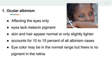 Albinism Pptx