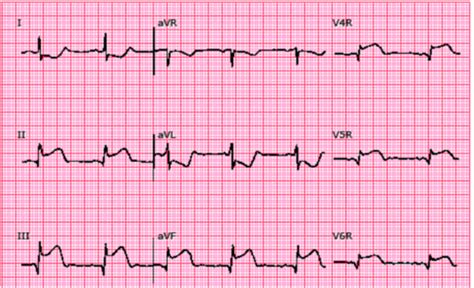 Simulation 6 Quiz Flashcards Quizlet