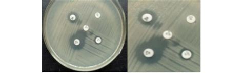 Aislado Productor De Blee E Coli C67 A Partir De Hisopado Rectal