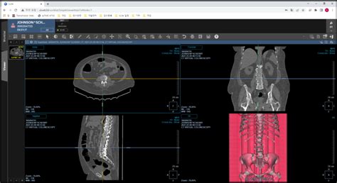 Infinitt Universal Viewer Ulite Zero Footprint Viewer For Medical