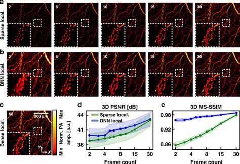 Deep Learning Acceleration Of Multiscale Superresolution Localization Photoacoustic Imaging