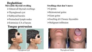 Thyroid Swelling Clinical Examination Pdf