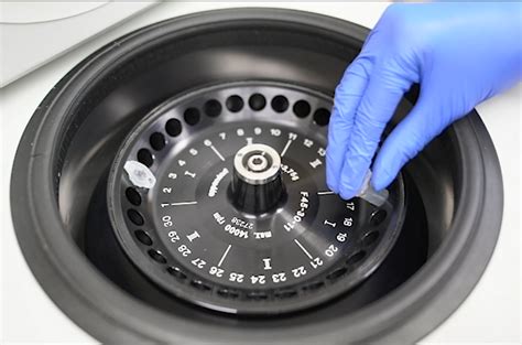 Pbmc Protocol Bruker Cellular Analysis