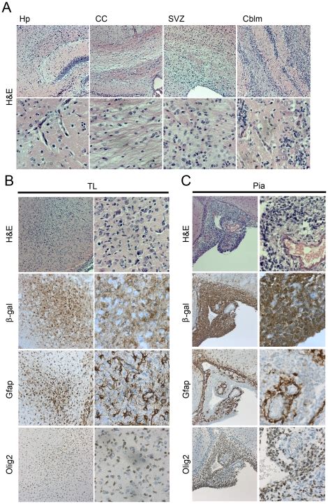 A Different Areas Of A Transgenic Mouse Brain With Neoplastic Download Scientific Diagram