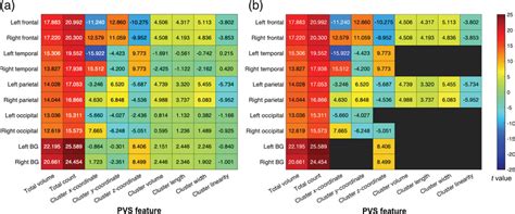 Univariate Importance Of Perivascular Space Pvs Features It