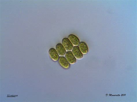 Spirogyra Under Microscope 400x Labeled