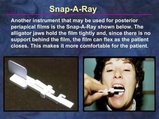 Radio Graphic Techniques Bisecting And Occlusal Pdf