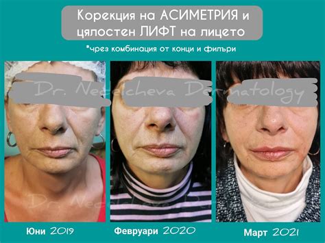 Дерматологичен център Д р Неделчева ️ Споделяме с вас невероятните резултати на една