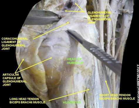 Head Of Humerus Anatomy In Cadaver Dissection Anatomy Note