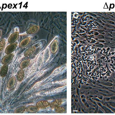 Examples Of Sexual Development Defects Produced By Deficient Download Scientific Diagram