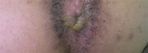 My Dirty Smelly Hole ThisVid Com